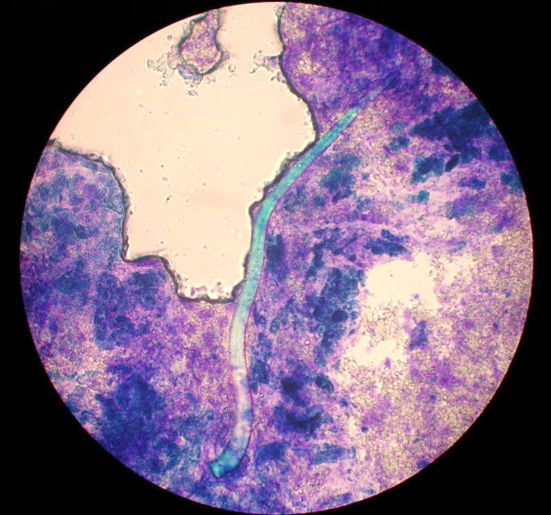 Bacteria In Yogurt Compound Microscope Yogurt Under The Microscope
